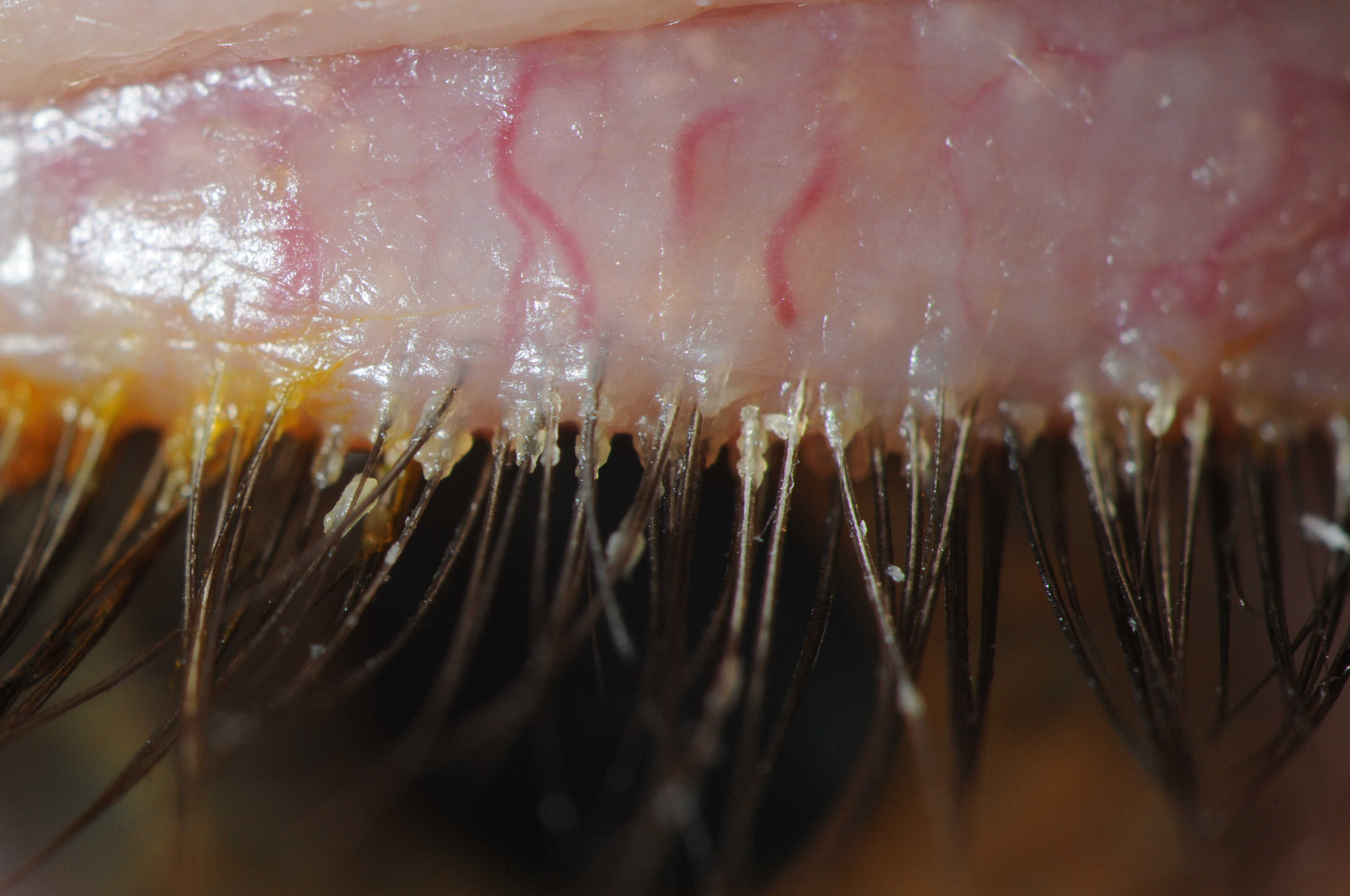 London Dry Eye Clinic - Welcome - Valerie Saw