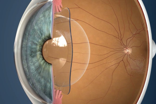 Treatments - An Introduction - Valerie Saw