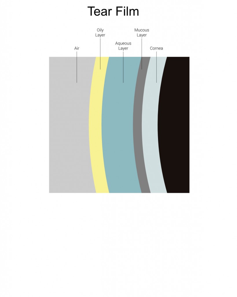 Dry Eye - Valerie Saw